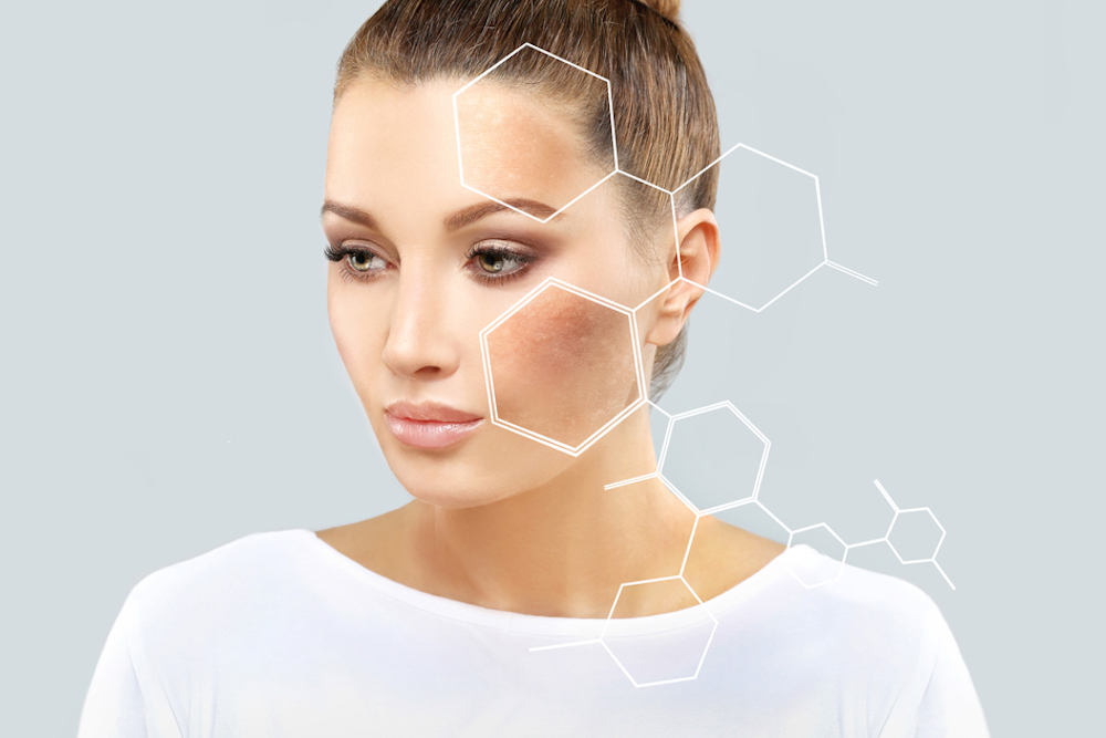 Comment prévenir l'apparition des taches brunes ? - Beauté chérie